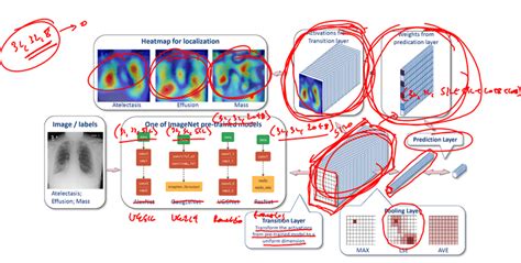 Nih Chest X Rays Classification And Localization On 45gb Of Freelancer
