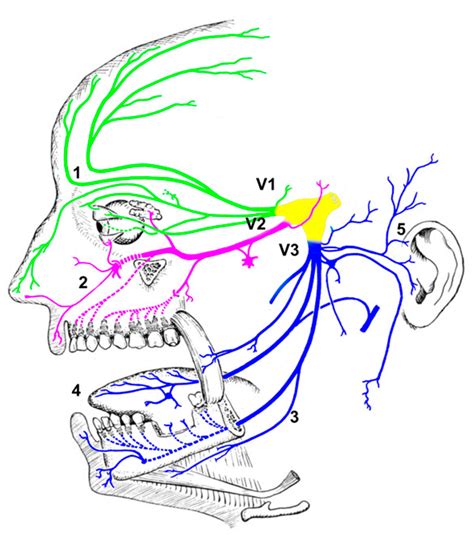 Trigeminal Nerve Stimulation