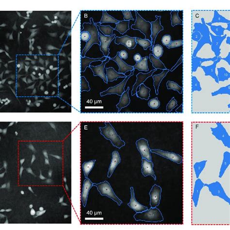 Segmentation Of Cell Regions Of Interest In The Phase Images For Download Scientific Diagram
