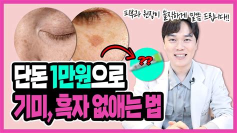 광고 피부과 안가고 기미 잡티 없애는법 레이저에 헛돈 쓰지마세요 이거로 집에서 미백 관리 하세요 💁🏻‍♀️ Youtube
