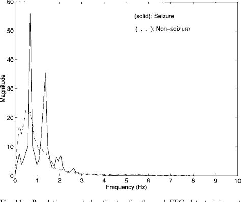 Figure 11 From Seizure Detection Of Newborn Eeg Using A Model Based Approach Semantic Scholar