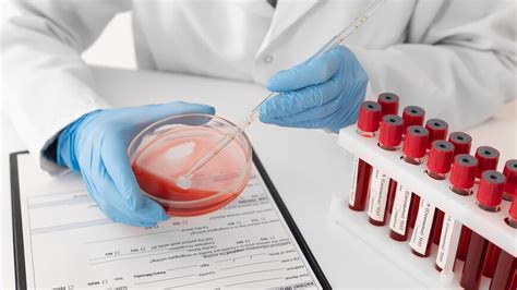 Why And When Should You Get A Hematocrit Test Onlymyhealth