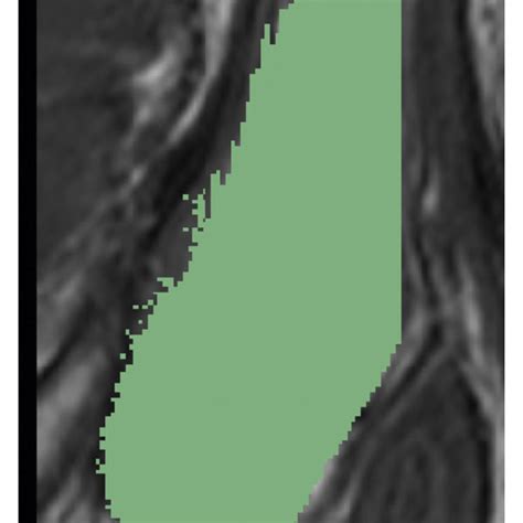 Radiomics Analysis Pipelineradiomics Analysis Pipeline For All Download Scientific Diagram