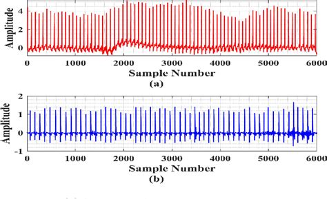 Figure 2 From Multiresolution Assessment Of Ecg Sensor Data For Sleep Apnea Detection Using Wide