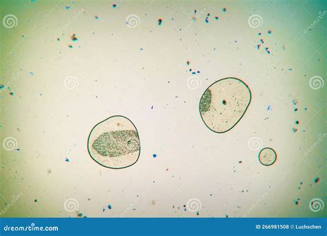 Biological Fluid At A Crime Scene Under A Microscope As Evidence Of A