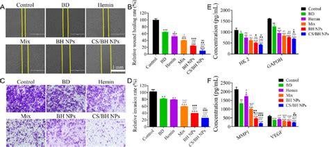 In Vitro CS BH NPs Inhibit The Migration And Invasion Of Breast Cancer Download Scientific