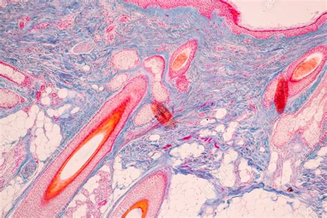 Scalp And Hair Follicles Of Human Under The Microscope In Lab 이미지 1399996246 게티이미지뱅크 Scalp And Hair Follicles Of Human Under The Microscope In Lab 이미지 1399996246 게티이미지뱅크