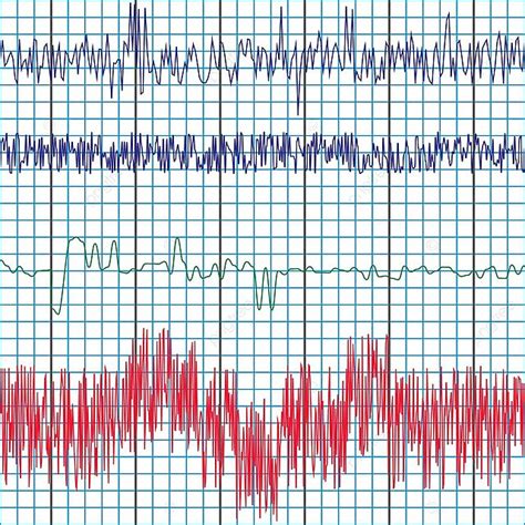 Screen Recording Polygraph Polygraph Instrument Sheet Vector Polygraph Instrument Sheet