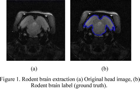 Figure 1 From Template Based Rodent Brain Extraction And Atlas Mapping Semantic Scholar