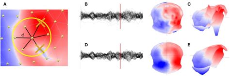 Eeg Source Imaging A Practical Review Of The Analysis Steps Pmc