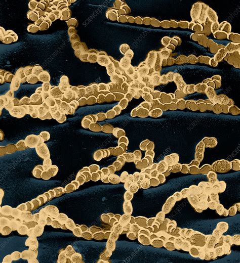 Streptococcus Bacteria Sem Stock Image C028 3119 Science Photo Library