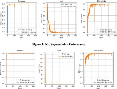 Figure 1 From A Deep Learning Model For Neural Network Optimization For Glaucoma Classification