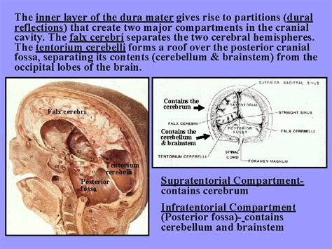 Gross Anatomy Of The Brain Dr G R