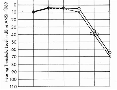 Audiogram D 25 Impedance Audiometrp Shows Bilaterally Normal Middle Download Scientific