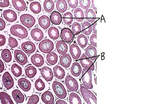 Lab Exam 4 Microscope Slides Flashcards Quizlet