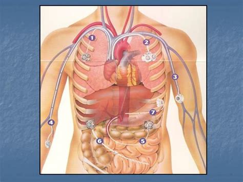 Quia Class Page Port Access Course Surgical Implantation