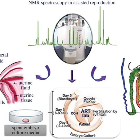 Schematic Of The Utility Of NMR Spectroscopy In Assisted Reproduction Download Scientific