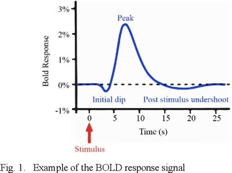 Figure 1 From Denoising Task Based Functional Magnetic Resonance Imaging Data Using Hybrid Deep