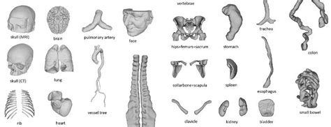 Medshapenet A Large Scale Dataset Of 3d Medical Shapes For Computer Vision Hans Lamecker