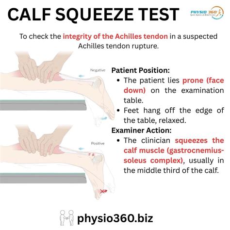The Calf Squeeze Test Also Known As The Thompson Test Is A Clinical Examination Used To Assess