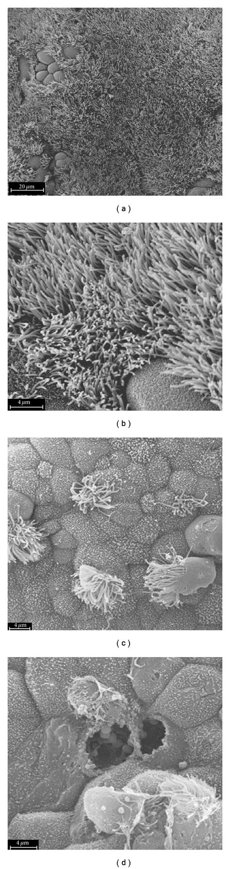 The Effects Of C Trachomatis Infection On Human Fallopian Tubal