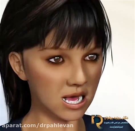 فیلم جراحی فک