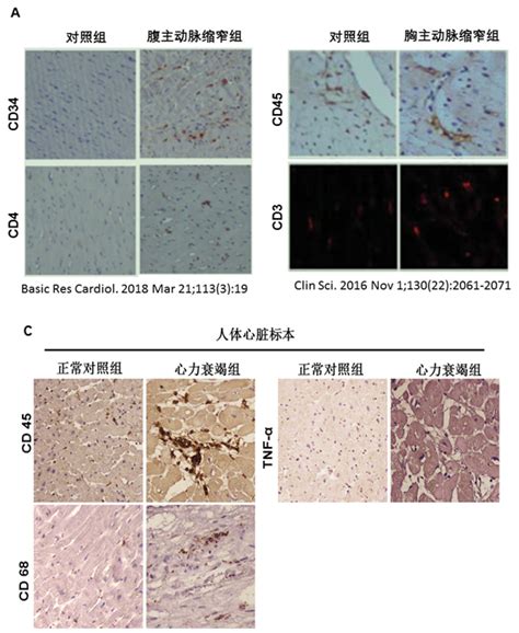 唐其柱教授：炎症与心力衰竭心力衰竭和心肌病网