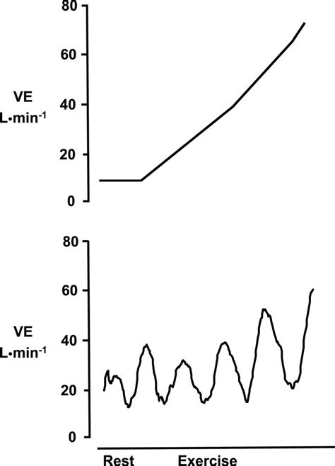 Examples Of Normal Ventilatory Pattern Top Panel And Exercise