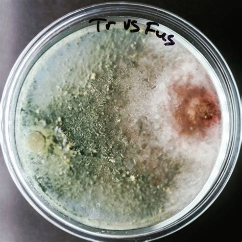 Std Testing Malaysia Fast Private And Reliable Screening He Medical