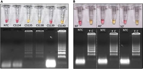 Frontiers Optimization And Clinical Validation Of Colorimetric Reverse Transcription Loop