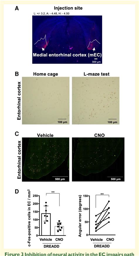 Figure 3 From Path Integration Deficits Are Associated With
