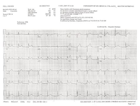 Differential Diagnoses Factors That Rule In STEMI In The Evaluation Of