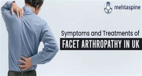 Ppt Facet Arthropathy Causes Symptoms And Treatments Powerpoint