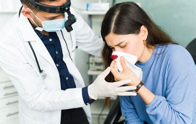 Get Your Epistaxis Coding Under Control Using These Q Procedure Focus