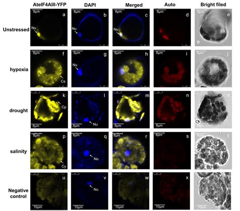 Sub Cellular Localization Of Ateif4aiii Yfp Under Normal Unstressed