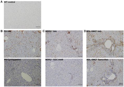 Hedgehog Controls Hepatic Stellate Cell Fate By Regulating Metabolism Pmc