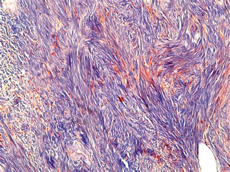 Massons Trichrome Stain Download Scientific Diagram