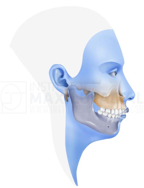 Clase Ii O Retrognatia Mandibular Cirugía Ortognática Instituto Maxilofacial