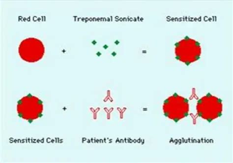 tpha principle procedure results interpretations microbe online