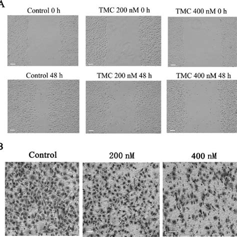 tmc suppresses the migration and invasion of breast cancer cells a