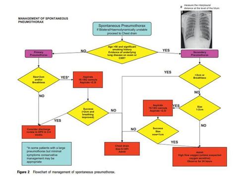 Algorithm For Management Of Spontaneous Pneumothorax Medizzy