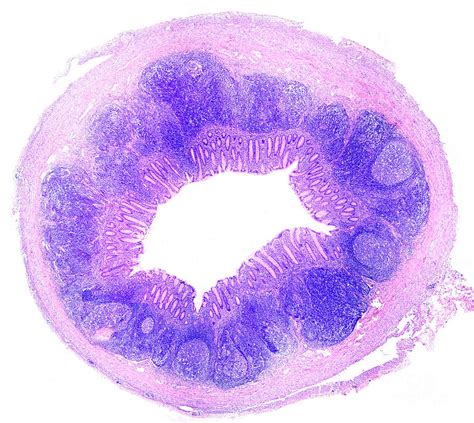 Human Appendix By Science Photo Library