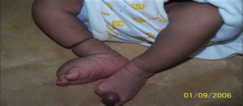 African Journal Of Paediatric Surgery