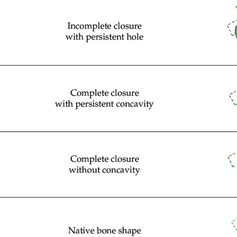 Scoring Scheme For µ Ct Evaluation Of Bone Reconstruction Shape The