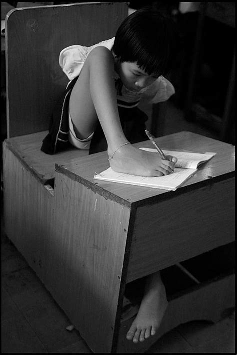 Alfred Yaghobzadeh Photography Vietnam Agent Orange Babies