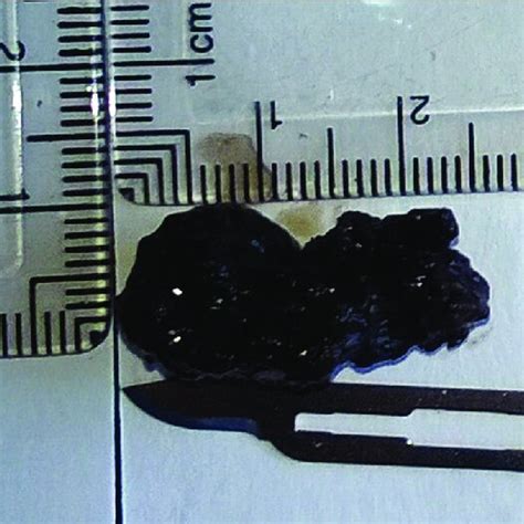 Surgical Gross Specimen Download Scientific Diagram