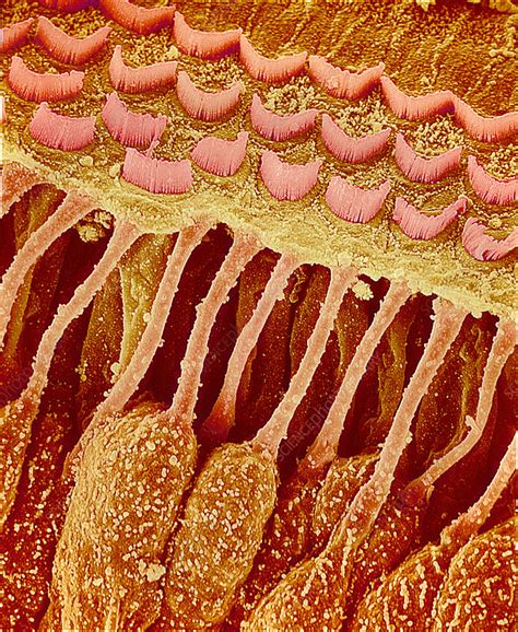 Sensory Hair Cells In Ear Coloured Scanning Electron Micrograph Sem Of Hair Cells Brow