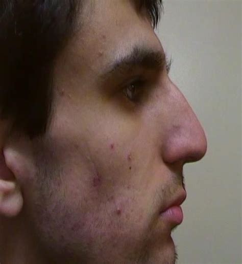 12 Sensational Convex Profile Hairstyle Men