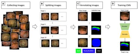 Medicina Special Issue Artificial Intelligence In Gastrointestinal Endoscopy Disrupting