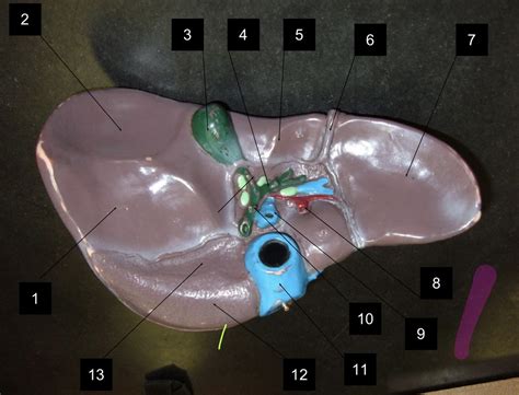Liver Diagram Quizlet